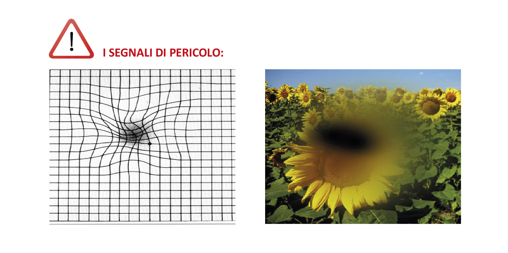 Quali sono i sintomi della Maculopatia? ecco i segnali di pericolo ...